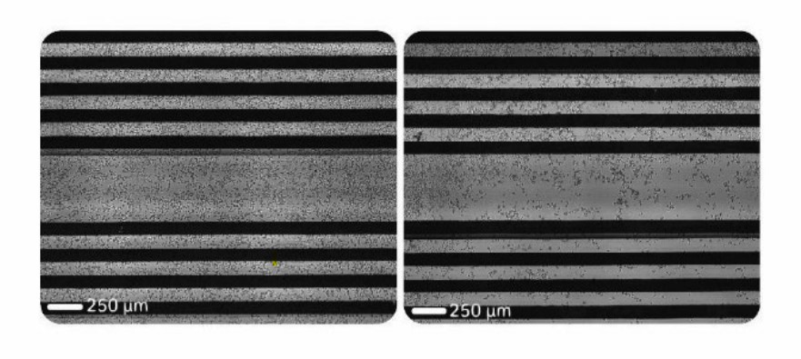 Development Of An In Vitro Cell Killing Assay For Liquid Tumor Cancer